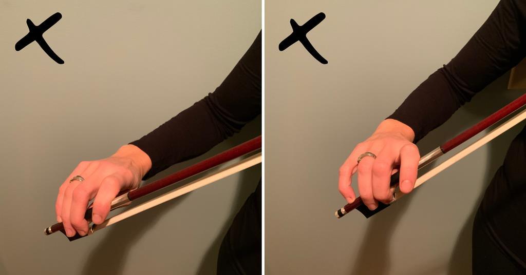 5 Ways Isolation Causes Bow Arm Fatigue | Focus | The Strad